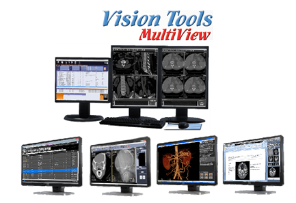 VisionTools MultiView Workstation διαγνωστικος σταθμος εργασιας | ICON ...